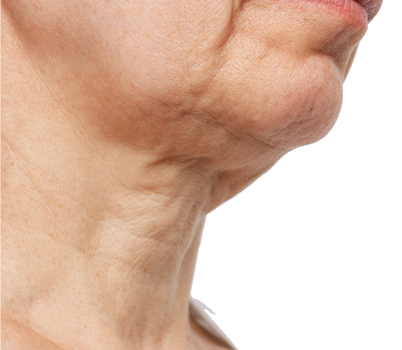 Cryo face lifts at Beauty Freak in Richmond/South Katy